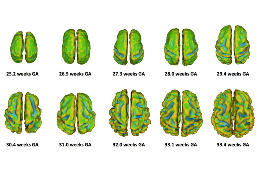 Neuro Brain Scans - Pioneering Minds